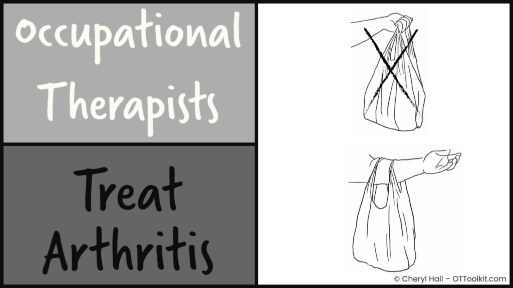 Occupational Therapists Treat Arthritis - OT Toolkit™ Blog Occupational Therapists Treat Arthritis - OT Toolkit™ Blog